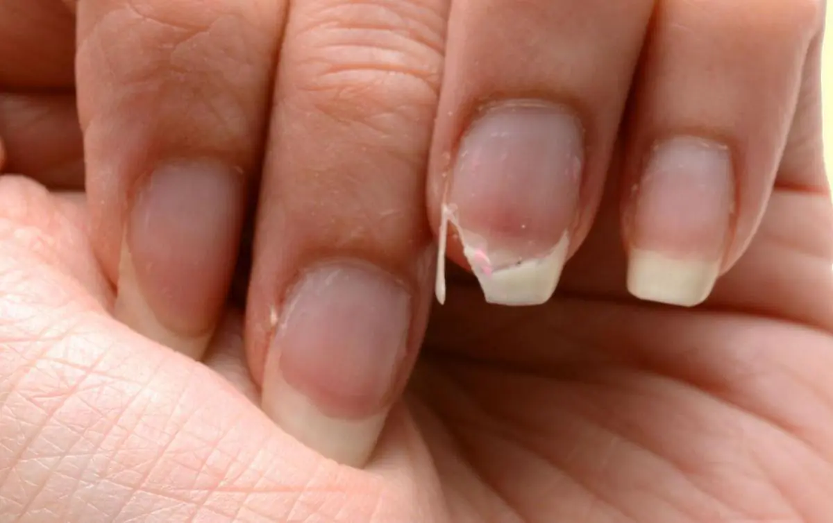 Unhas Fracas E Quebradiças 3 Dicas Para Fortalecê Las Portal Sbn